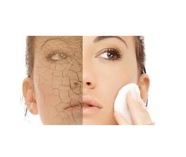 Dry Skin On Face