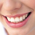 How to Get Naturally White Teeth