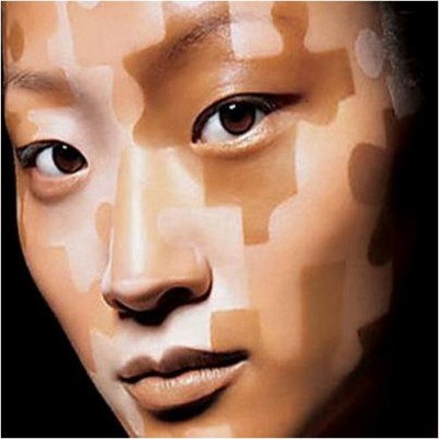 How to Cure White Spots On Skin