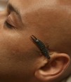 How to Remove Bugs from Ears