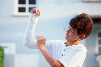 How to Treat a Broken Arm
